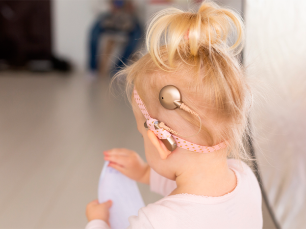 ¿Qué es el Implante Coclear | Centro Optico Social